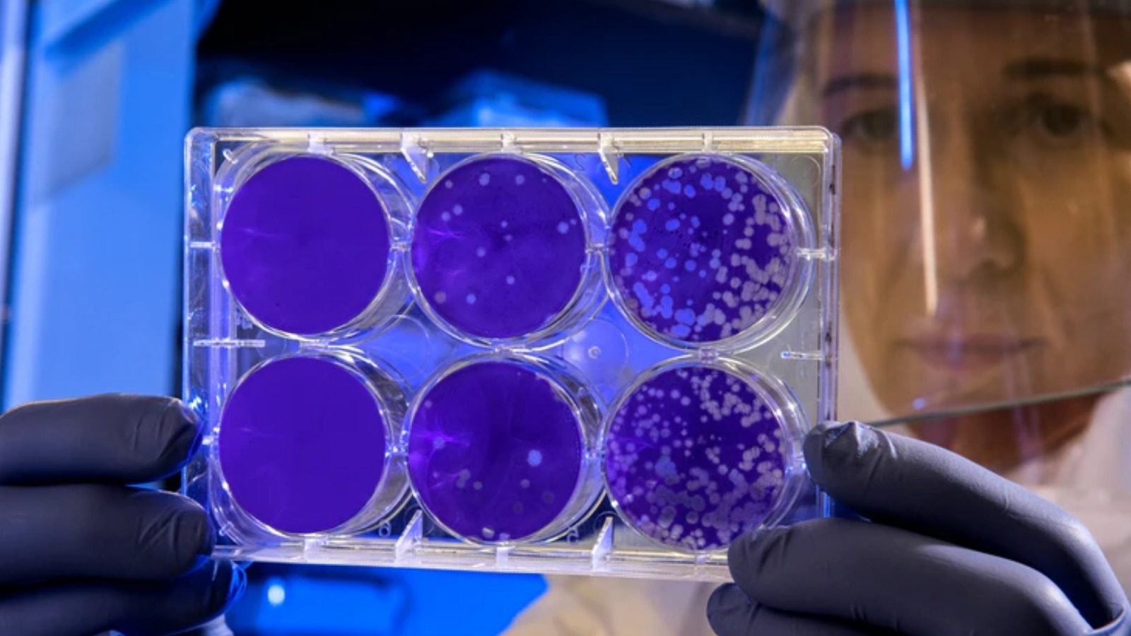 Study says Cancer-causing virus affects glial cells in CNS